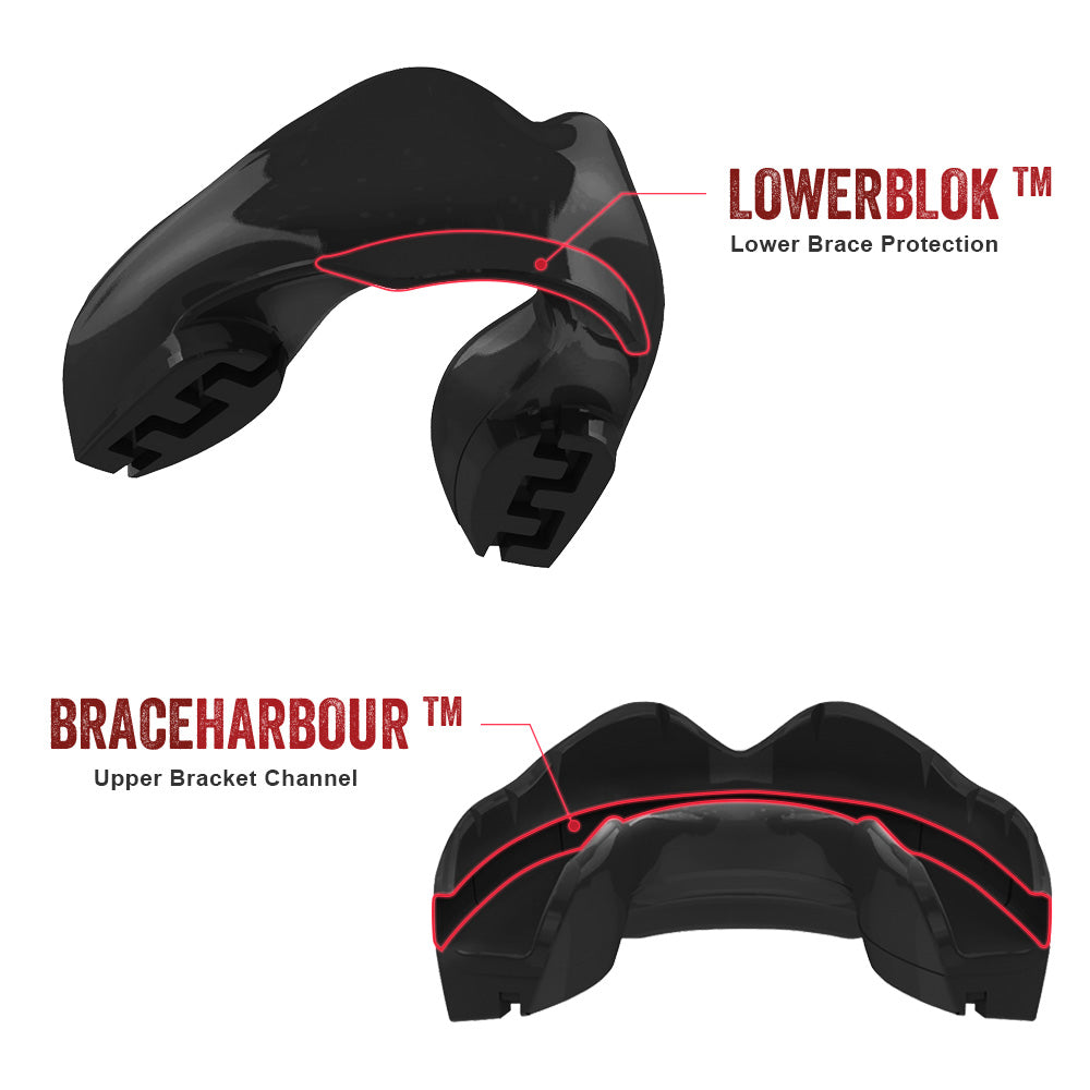 SAFEJAWZ® Ortho Series Mouthguard for Braces - Black